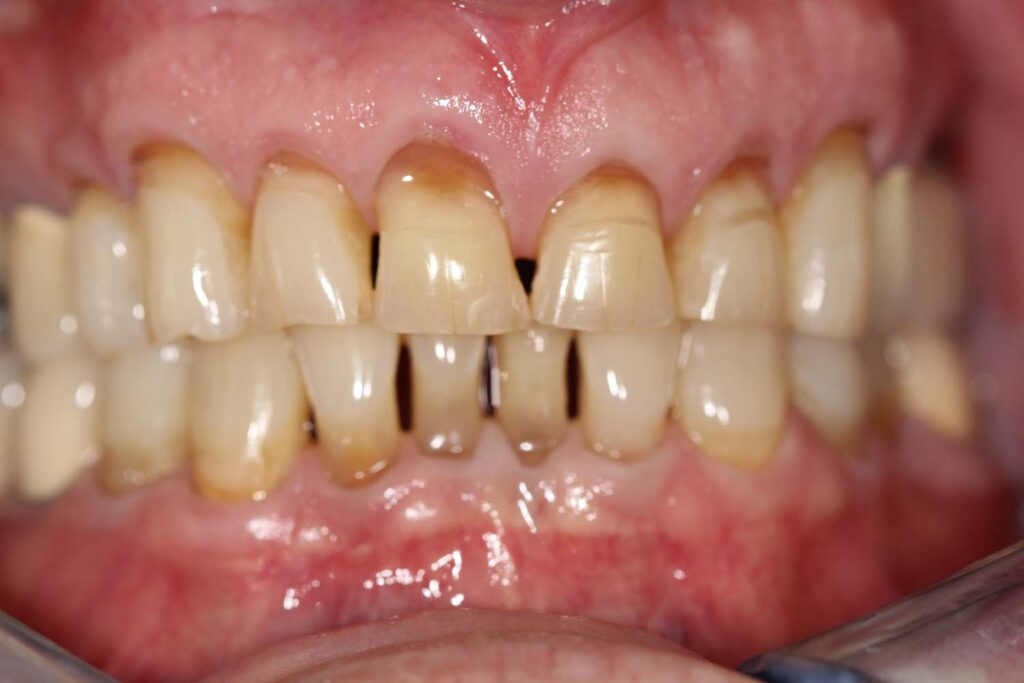 Princeton Prosthodontics And Dental Implants | Princeton, NJ